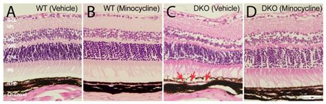 The Effect Of Minocycline On Retinal Structure In Histological