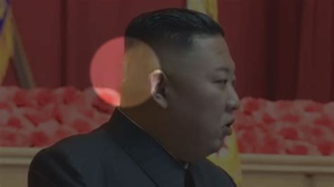 金正恩早前開會時後腦疑貼上膠布 Now 新聞