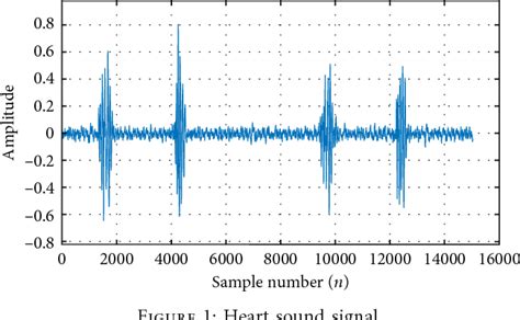Figure 1 From Performance Of Adaptive Noise Cancellation With Normalized Last Mean Square Based