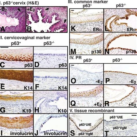 Phenotypes In Normal And Abnormal Uterine And Cervicovaginal Epithelia