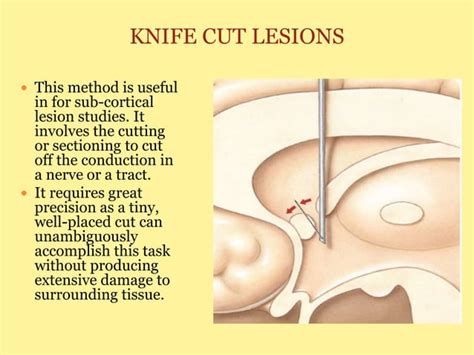 Ablation And Lesion Pptx