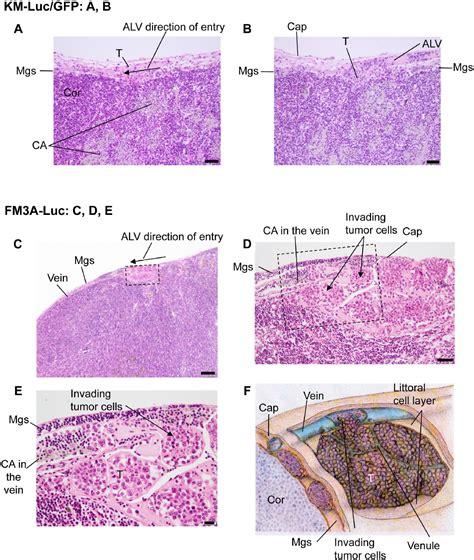 Intrapulmonary Lymph Node A Marginal Sinus Lymphoid Frontiers The