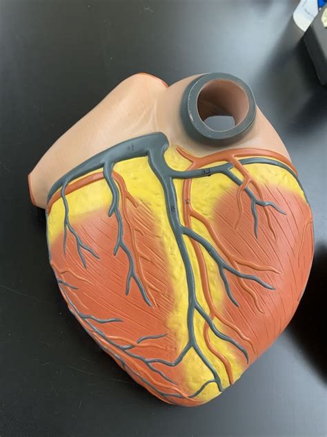 Heart Model 4 Inf Diagram Quizlet