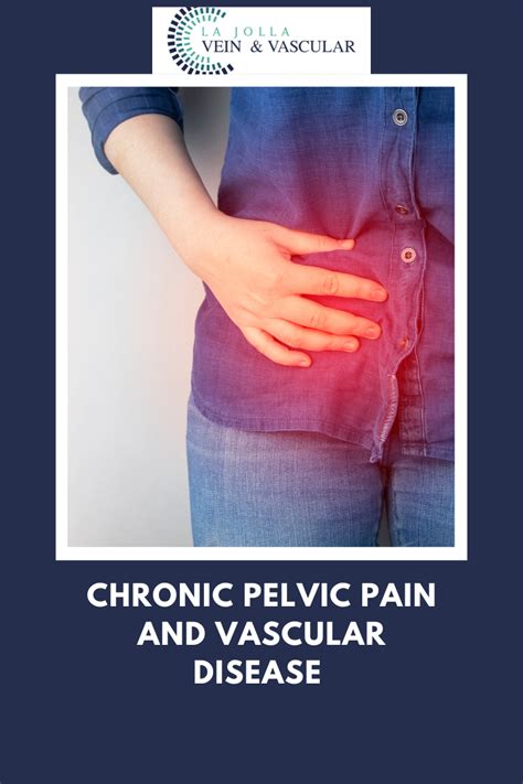 Vein And Vascular Treatment Chronic Pelvic Pain