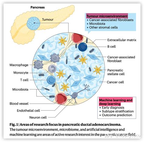 胰腺癌肿瘤微环境进展、微生物和ai 知乎