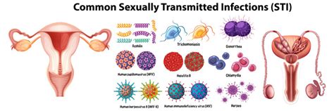 Common Sexually Transmitted Infections Sti Vector Image