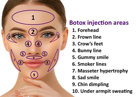 How Much Is Botox For 3 Areas Cosmetic Surgery Tips