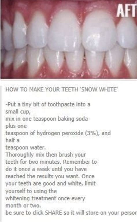 Pin By Jasmine Louise On Herbalist Teeth Whitening Methods Teeth