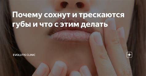 Почему сохнут и трескаются губы и что с этим делать Evolutis Clinic Дзен