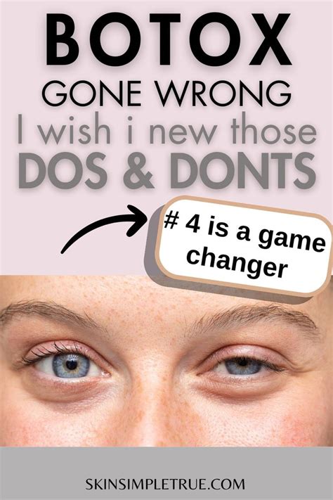 Worst Botox Complication Droopy Eyelid Learn The Botox Dos And Donts To Prevent It In 2024
