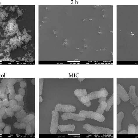 Observation Of Crkp By Sem Crkp Treated With Mic Mdeo For 0 H 2 And