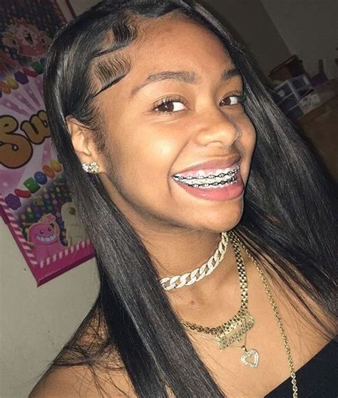 19 Baddies With Braces Ideas To Save Today Cute Braces Cute Braces