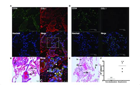 Identification Of Col I Cd34 Fibrocytes In The Lung Tissue Of Download Scientific