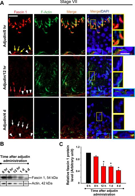 Figure 4 From Fascin 1 Is An Actin Filament Bundling Protein That