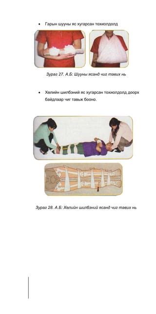 Осол гэмтлийн үед үзүүлэх анхны тусламж Pdf