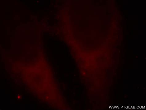 Integrin Beta 6 Fusion Protein Ag29002 Proteintech