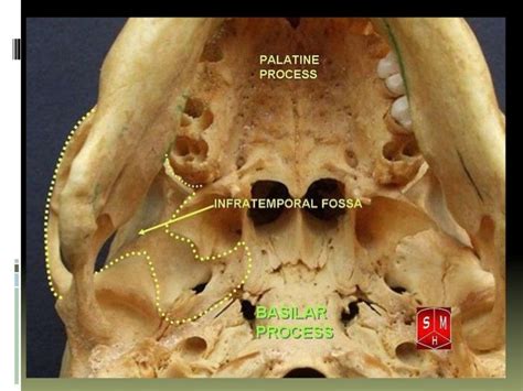 Infratemporal Fossa Torres