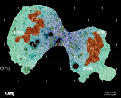 Cancer Cell Division Coloured Transmissionelectron Micrograph Tem Of