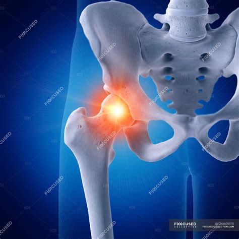 Illustration Of Painful Hip Joint In Human Skeleton On Blue Background