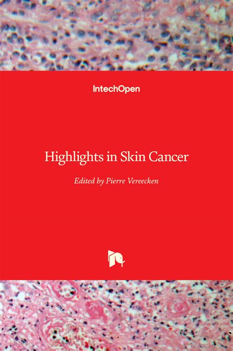 Highlights In Skin Cancer Intechopen