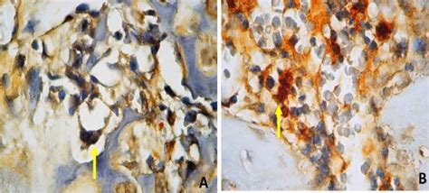 Immunohistochemical Staining Shows Ocn Expression Yellow Arrow 1000x Download Scientific