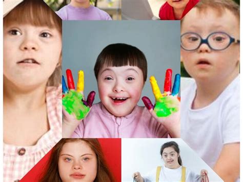 НҮБ ын Ерөнхий ассамблейгаас тунхагласан дауны хам шинжийг таниулах өдөр тохиож байна Isee Mn