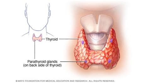 Hospital Iranshahr On Linkedin ۱ علل پرکاری پاراتیروئید چیست؟ در