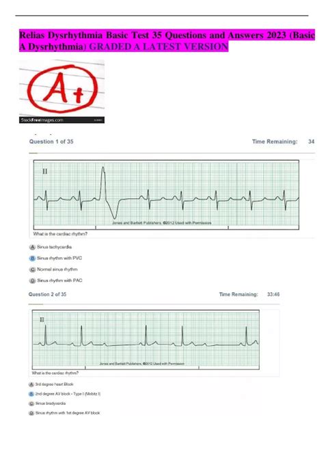 Relias Dysrhythmia Basic Test 35 Questions And Answers 2023 Basic A
