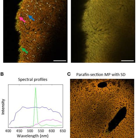 Mp Excitation Spectral Imaging For Liver Tissues Of The Ccl4 Induced