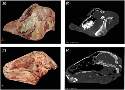 2d Ct Scan Images Longitudinal View Bone Window And Cross‐sectional