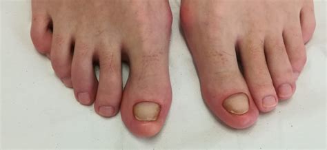 La Importancia De Las Pedicuras Y Manicuras ~ Vicen Belleza Y Salud