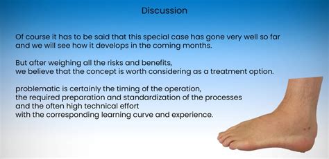 Calcaneal Fracture Comminuted Minimal Invasive Treatment Of Calcaneal