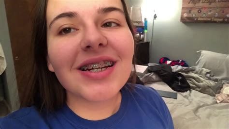 BRACES UPDATE Vlogmas Day YouTube