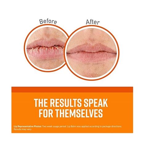Okeeffes Unscented Lip Repair Lip Balm For Dry Cracked Lips Stick