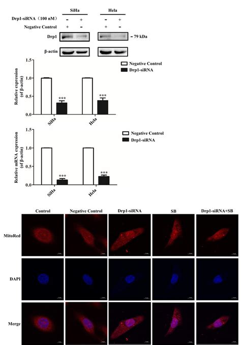 Sb Induces Mitochondrial Dynamic Dysfunction In Cervical Cancer Cells