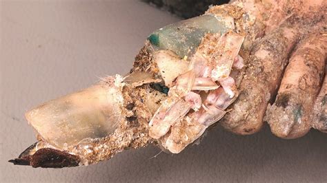 Extremely Long Toenails Abnormal Growth Of Black Mud 👣 Professional