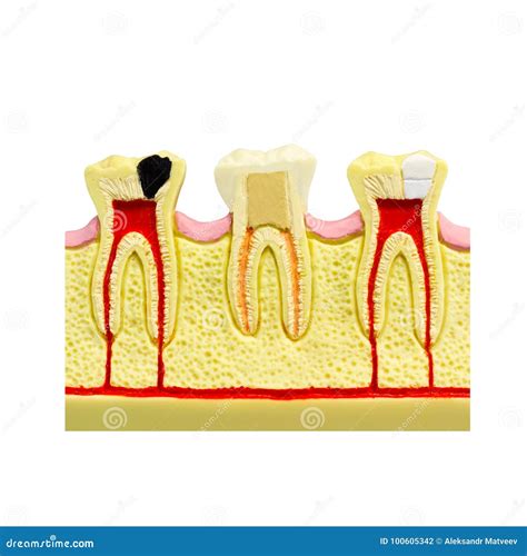 Human Tooth Gum Cross Section Tooth Root Canal Tooth Detailed Anatomy Tooth Color Image