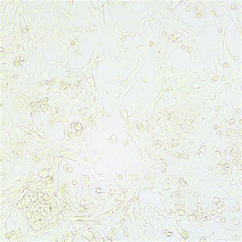 Hepa1 6细胞（小鼠肝癌细胞）科研专用，厂家直发 产品关键词hepa1 6小鼠肝癌细胞细胞hepa1 6hepa1 6细胞