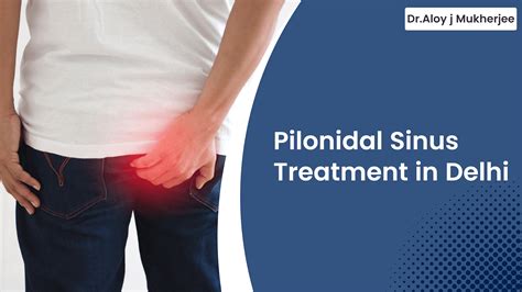 Pilonidal Sinus Treatment In Delhi India Dr Aloy Mukherjee