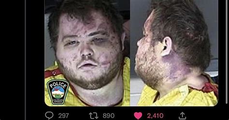 Non Binary Bitch Please What A Coward Smh Album On Imgur