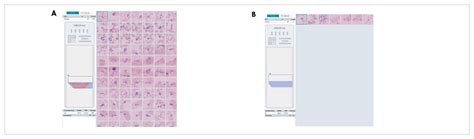 Hemabook Chapter 25 Leading The Way In Platelet Counting Innovation