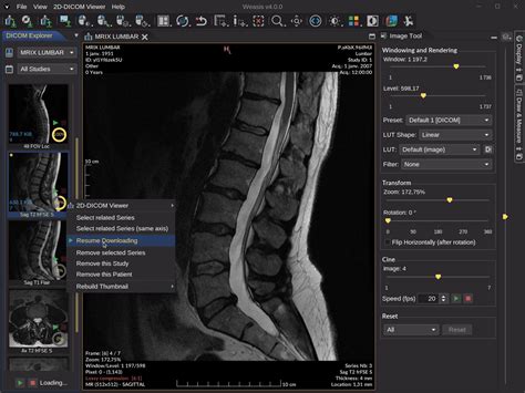 Dicom Import Weasis Documentation