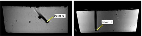 Mri Images Show The Needle Artifact And It Confirms That The Needle