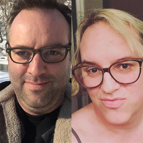 47 Years Old 6 Months Pre Hrt Vs 16 Months Hrt Rtranstimelines