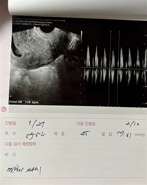 임밍아웃 5주~12주 검진기록 임신초기증상1차기형아검사성별확인 네이버 블로그