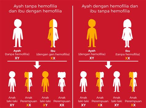 Inilah Penyakit Menurun Seperti Hemofilia disebabkan oleh? - Pasundan Ekspres