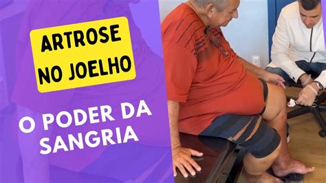 Artrose No Joelho Dornojoelho Artrose Acupuntura Youtube