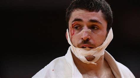 Las graves heridas en el rostro que sufrió un judoca español tras caer ante el seis veces