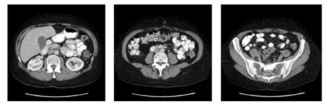 CT Image Production Data Acquisition Flashcards Quizlet