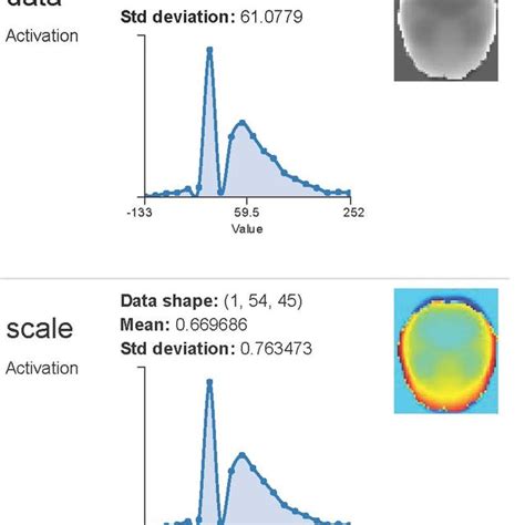 Pdf Classification Of Alzheimers Disease Using Fmri Data And Deep Learning Convolutional